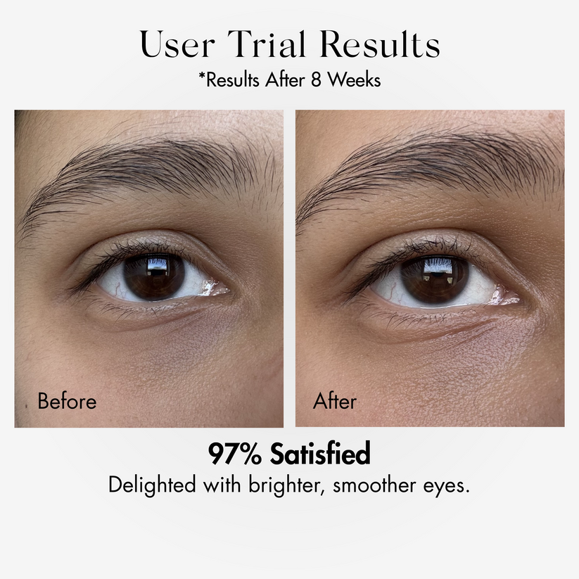 BRIGHT-EYED Brighten + Firm Eye Cream - Advanced Under-Eye Treatment