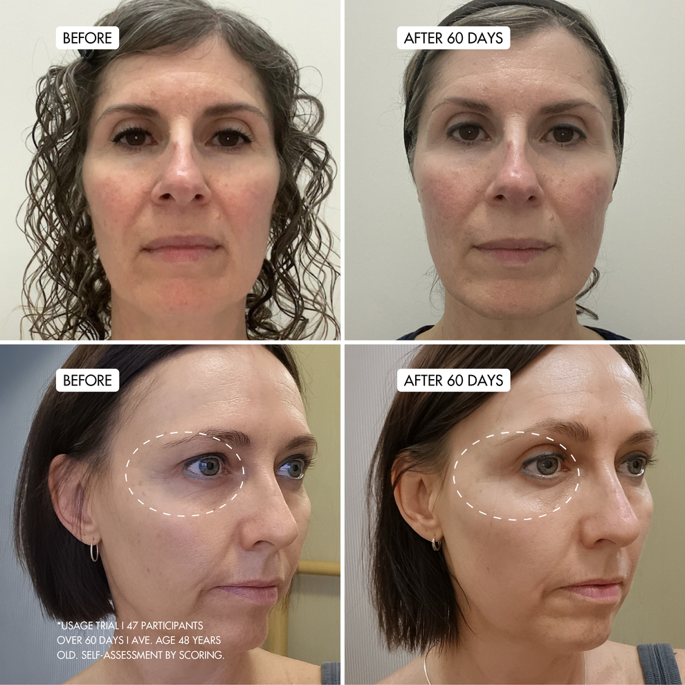 RETININ® NIGHT 0.1% Retinal Firming Treatment | SKOON.