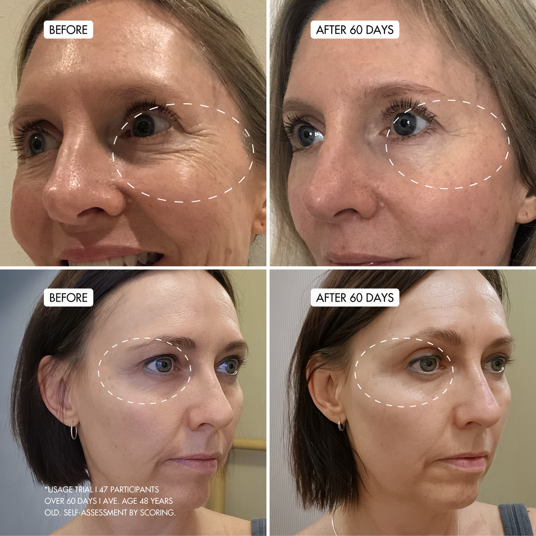 RETININ® NIGHT 0.1% Retinal Firming Treatment | SKOON.